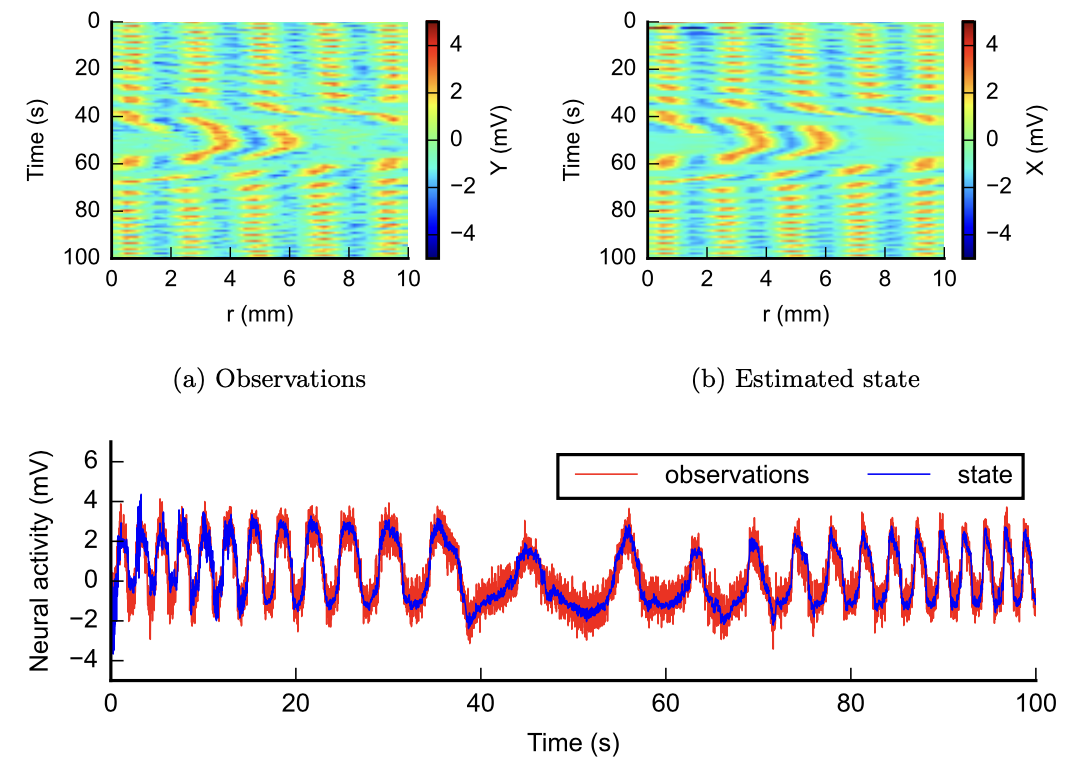 State and Parameter Estimation for a Neural Model of Local Field Potentials